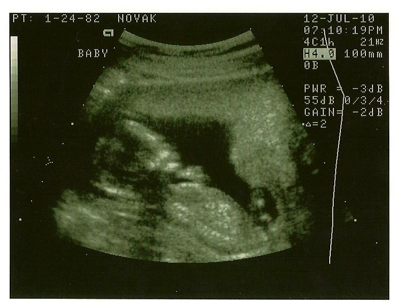 Baby Novak: 14 weeks - The start of the 2nd trimester