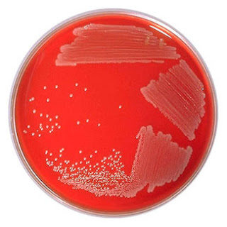 Bacterial Culture Media: classification, types and uses