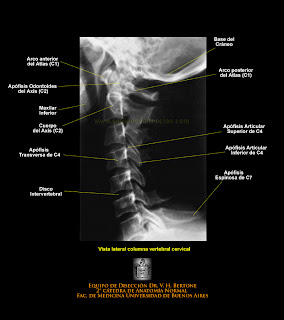 rx: Rx Perfil Columna Cervical