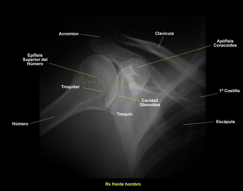 rx: Rx Frente Articulación Escapulo Humeral