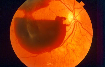 TREAT WITH THE WHOLE-HEARTED: eye: 6