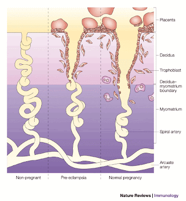 What Causes Hyperreflexia And Clonus In Preeclampsia