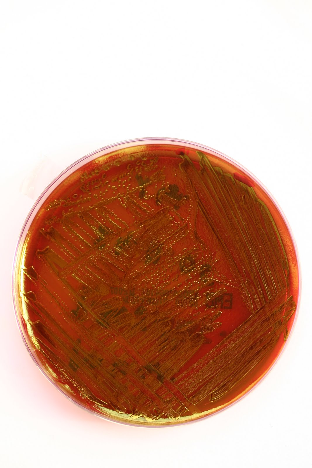 LABORATORIO Y MICROBIOLOGÍA: EMB.