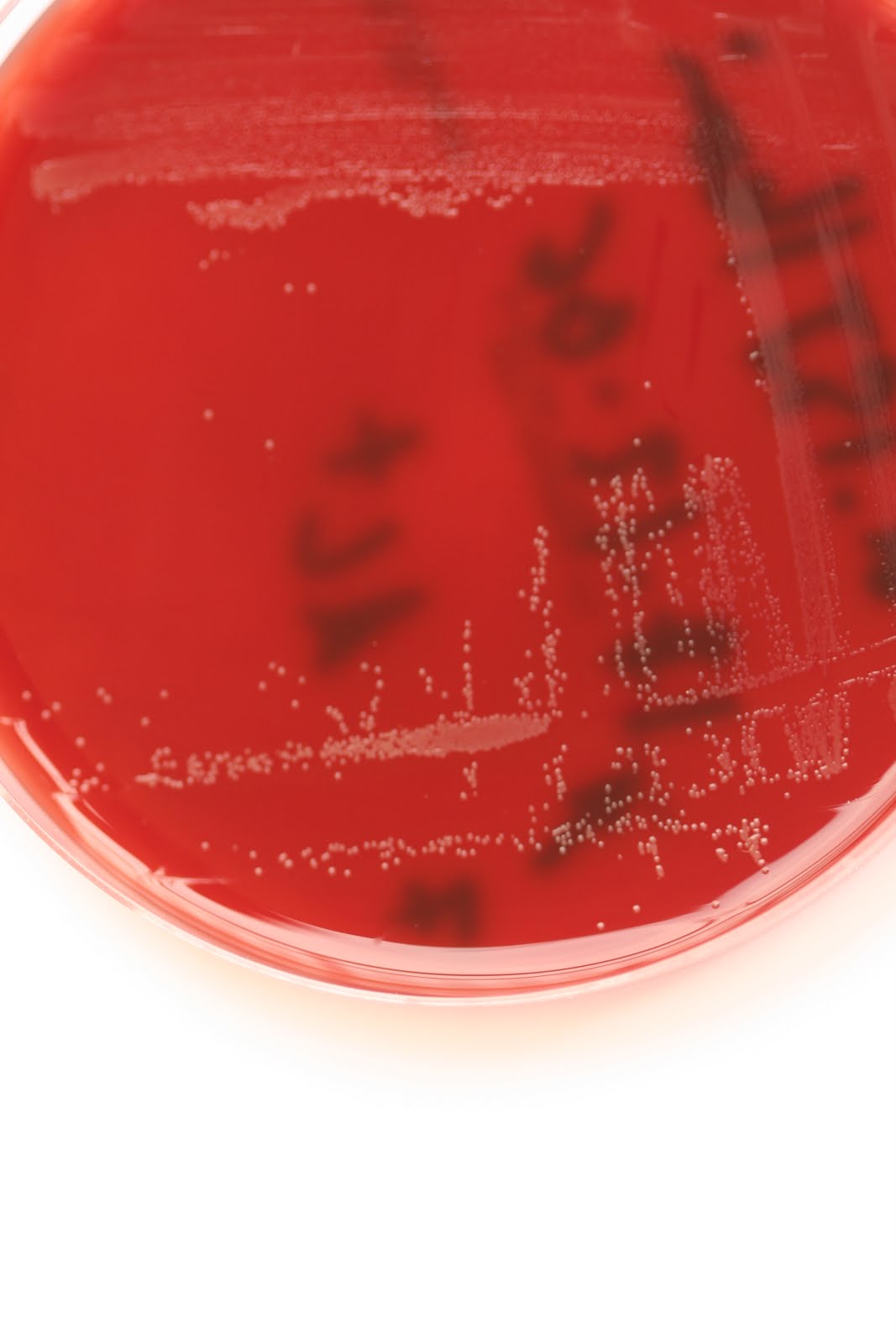 LABORATORIO Y MICROBIOLOGÍA: GÉNERO CAMPYLOBACTER.