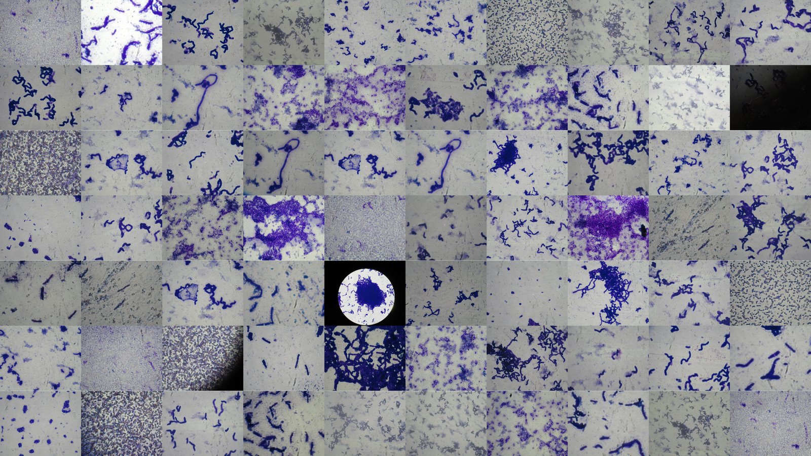 Discovery-Of-Bacterial-Gold-In-Goa: Rock eating bacteria isolated from ...