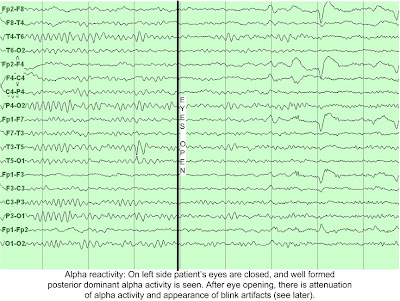 NEUROLOGY INVESTIGATIONS: ALPHA RHYTHM
