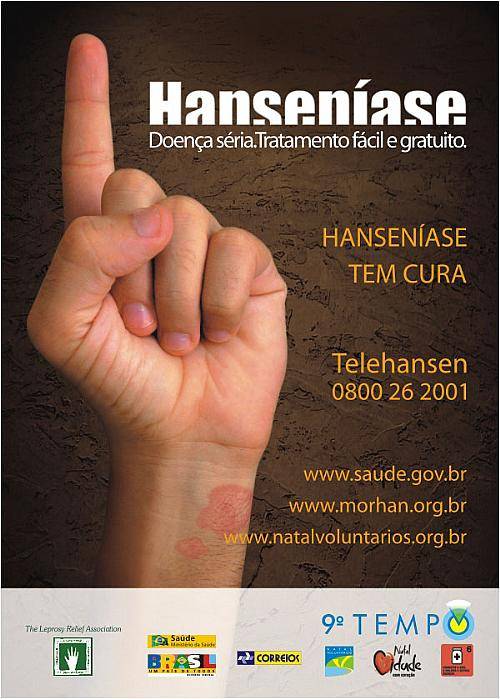 kantinhupatologyck.fisio3: Hanseníase