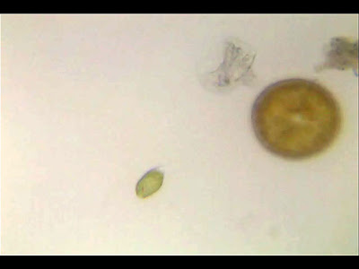 Encyclopedian Dictionary ( Eyespots on Protozoa ): Darwin's Eye