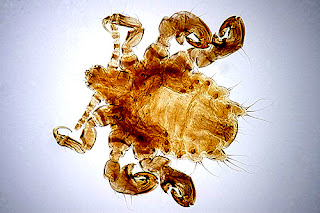 ENFERMEDADES DE TRANSMISION SEXUAL: ENFERMEDADES DE TRANSMISION SEXUAL