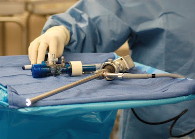 chirurgie coelioscopique