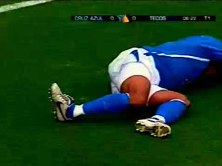 Just Football !!: The Worst Football Injuries