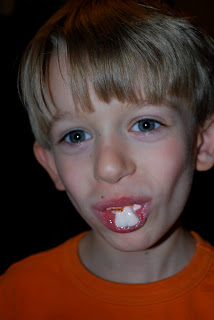 Me Myself and ... who am I kidding, it's all about the kids!: Bunny Teeth