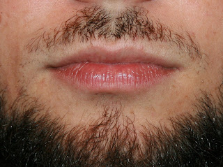 My journey to end facial hair pulling