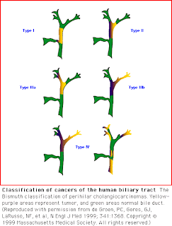 Helmut: Colangiocarcinoma