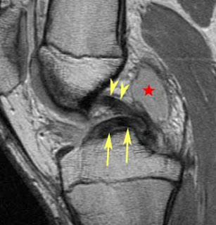 RiT radiology: January 2009