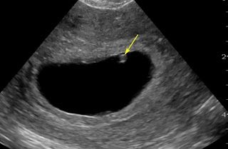 RiT radiology: July 2009