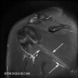 RiT radiology: January 2011