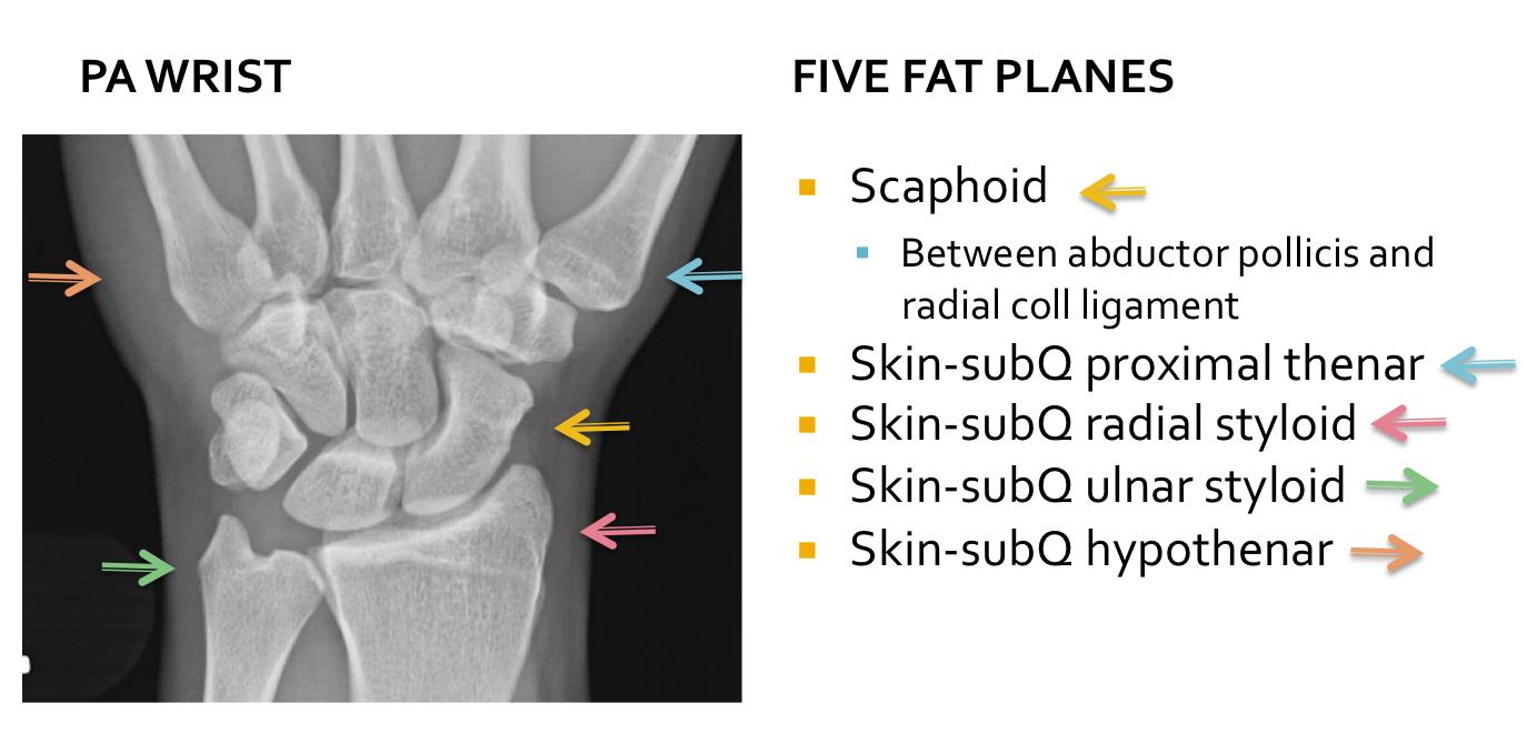 RiT radiology: Soft Tissue Evaluation on Wrist Radiography