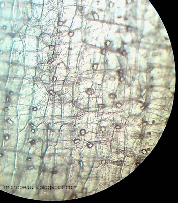 The Wonderful Microworld: Onion Skin Cells (Onion Scales) (Outer most ...