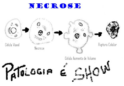 Patologia é Aqui: Necrose