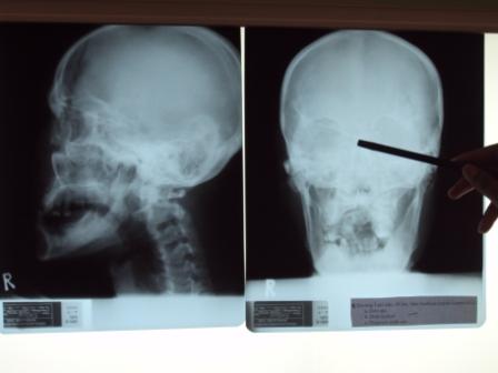 catatan KaKa Es...tak ada kata telat untuk rajin..: DESKRIPSI FOTO X-Ray