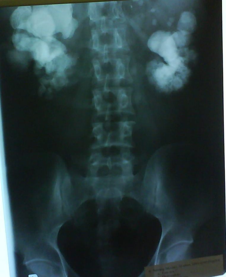 catatan KaKa Es...tak ada kata telat untuk rajin..: DESKRIPSI FOTO X-Ray