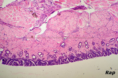 Macro y microfotografia: Microfotografía: Lengua de rana