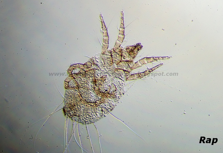 Macro y microfotografia: Microfotografía: Ácaro de agua (2)