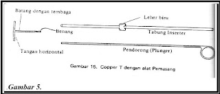HEALTHY CAU'S: KONTRASEPSI IMFLAN/AKBK, IUD/AKDR, KONTAP