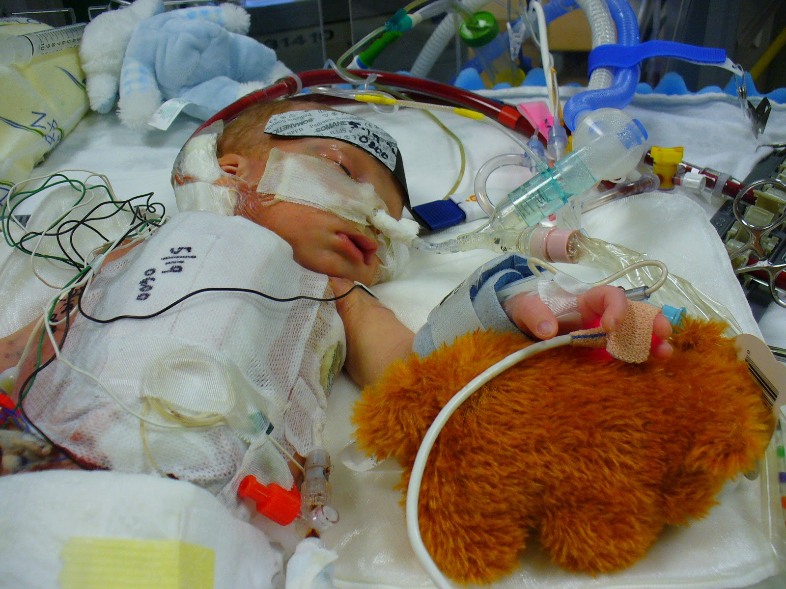 The Baer Bunch: ECMO wean attempt #2