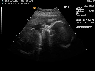 Just the FOUR of us!: 28 week ultrasound