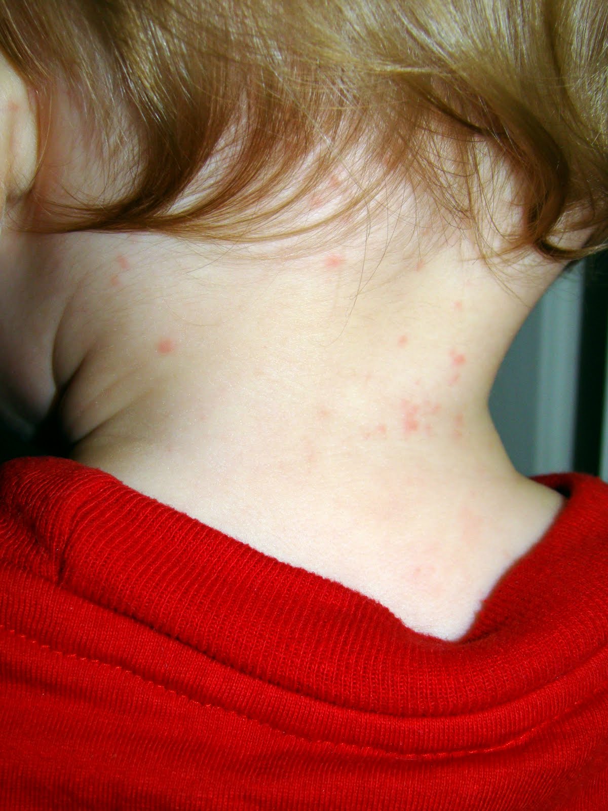 Rash - The Journey of Parenthood...