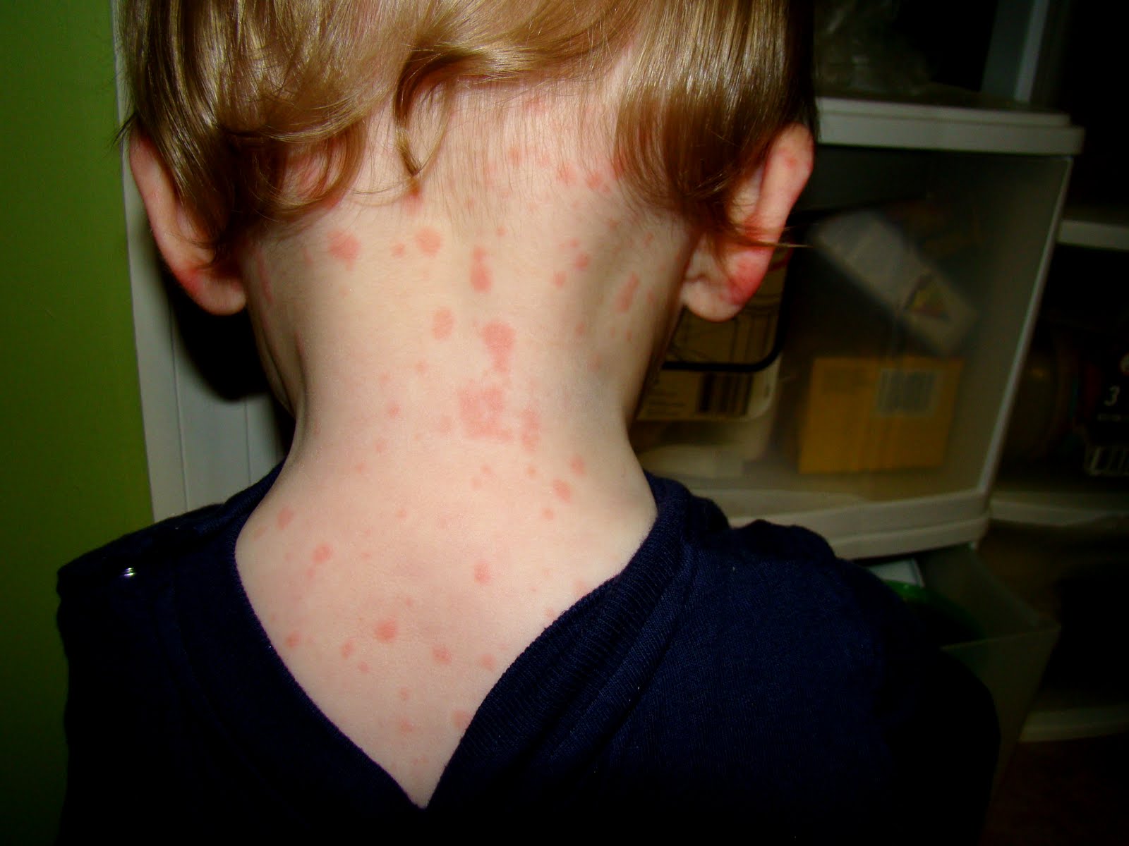 Rash - The Journey of Parenthood...