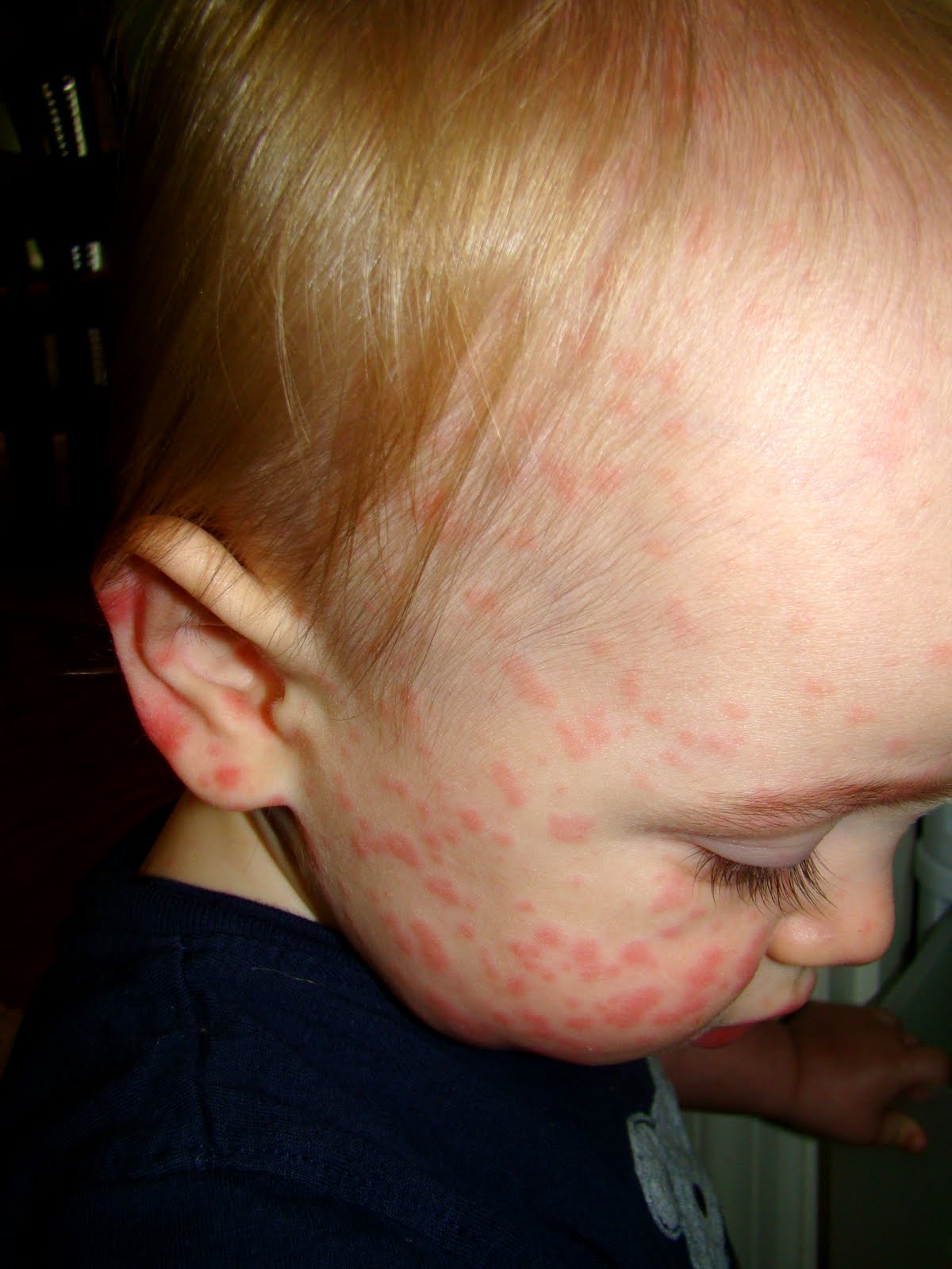 Rash - The Journey of Parenthood...