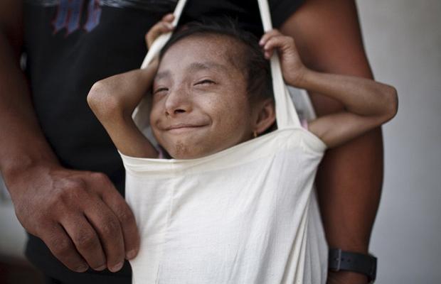 world-amazing: World Smallest Man Images