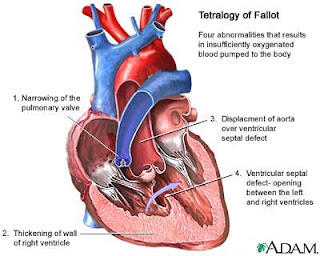 Baby B Bulletin: TOF