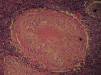 IMAGENES PATOLOGIA