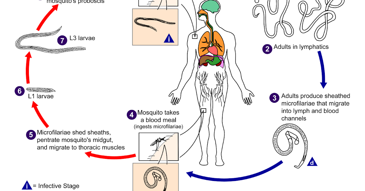 ISHARMANTO - BIOLOGI GONZAGA: FILARIASIS-KAKI GAJAH