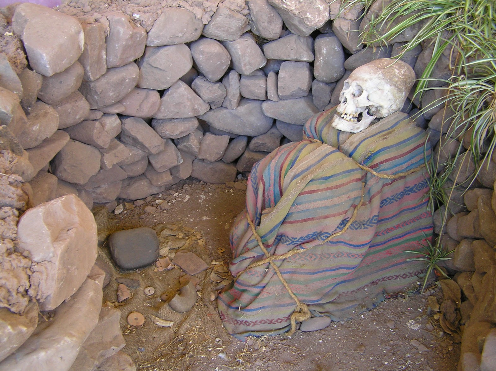 A lifetime of crazy, fun and unique adventures!: Inca head surgery