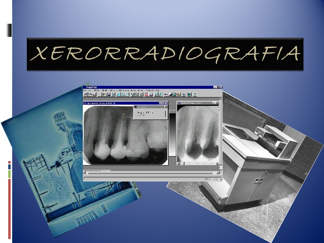 Xerorradiografia