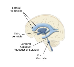 Our Life And Such: The Third Ventriculostomy