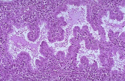 Pathology: Micro 1, 2