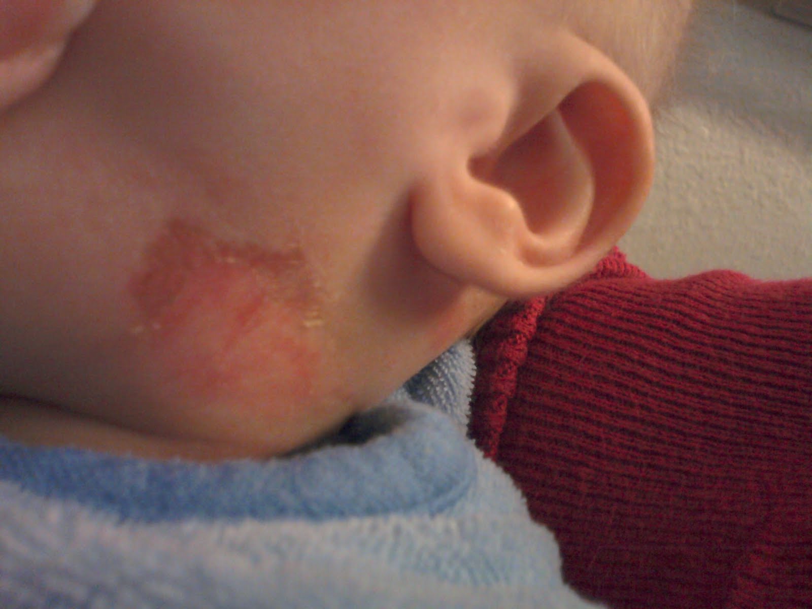 Blessed Life: Non Specific Rash.