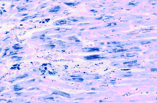 Prussian Blue Stain