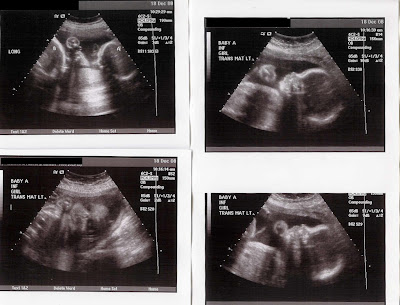 It's twins for the twins!: 28 week ultrasound photos