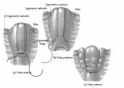 Técnica de B-Lynch: B-Lynch no Brasil