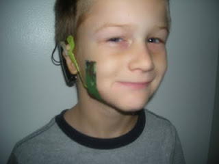 Cochlear Kids: The boy with three "ears"