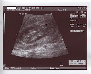 Matt, Christy, Ally, Tommy, & Natalie: 12 Week Ultrasound ~ Nuchal ...