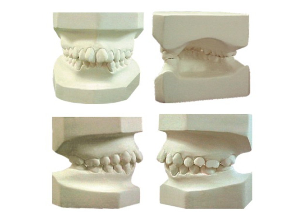 Odontología UNAH-VS: Modelos de Estudio Dental