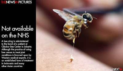 Apitherapy News: Photos of Bee Venom Therapy in Indonesia